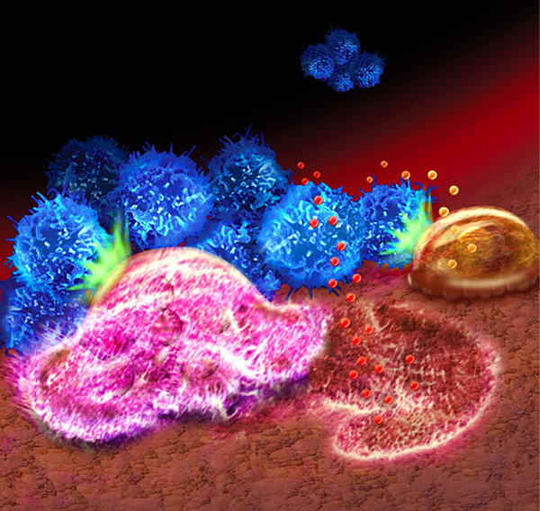 Η ΦΛΕΓΜΟΝΗ ….Ο ΚΡΥΦΟΣ ΕΝΟΧΟΣ ΓΙΑ ΤΟΝ ΚΑΡΚΙΝΟ | Bioathens