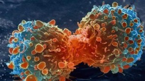 ΤΑ ΣΗΜΑΔΙΑ ΤΟΥ ΚΑΡΚΙΝΟΥ ΤΟΥ ΠΝΕΥΜΟΝΑ ΠΟΥ ΠΡΕΠΕΙ ΝΑ ΓΝΩΡΙΖΕΤΕ | Bioathens