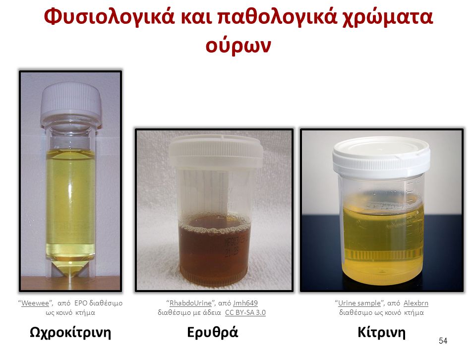 ΑΜΕΡΙΚΑΝΟΙ ΕΙΔΙΚΟΙ ΕΞΗΓΟΥΝ..ΤΙ ΑΚΡΙΒΩΣ ΔΕΙΧΝΕΙ ΤΟ ΧΡΩΜΑ ΤΩΝ ΟΥΡΩΝ ...